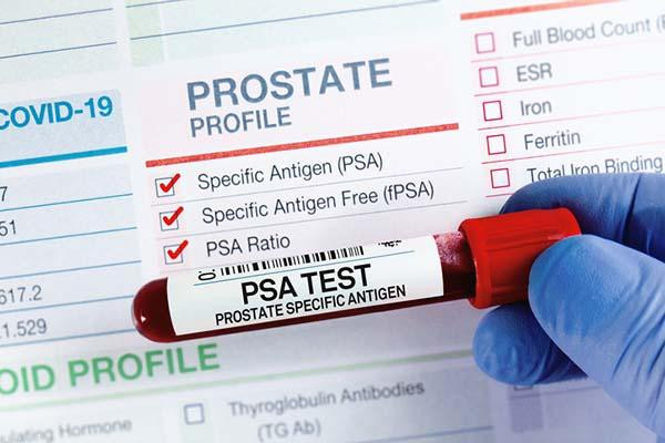 Koji su simptomi raka prostate? | Rešimo Probleme | Rešimo Probleme